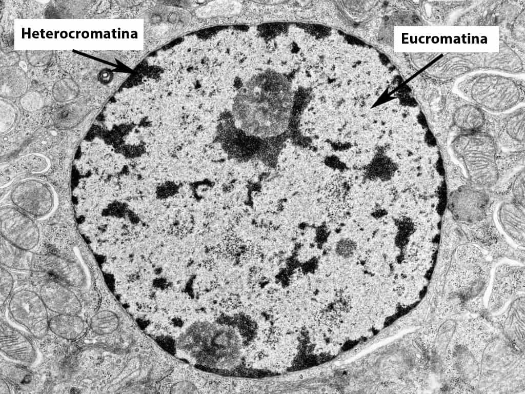 eucromatin-y-heterochromatin-nucleo-microscopio – BIOLOGÍA y GEOLOGÍA