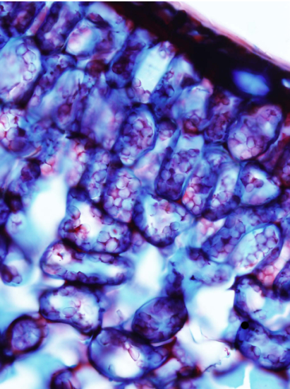 MERISTEMOS SECUNDARIOS – BIOLOGÍA y GEOLOGÍA